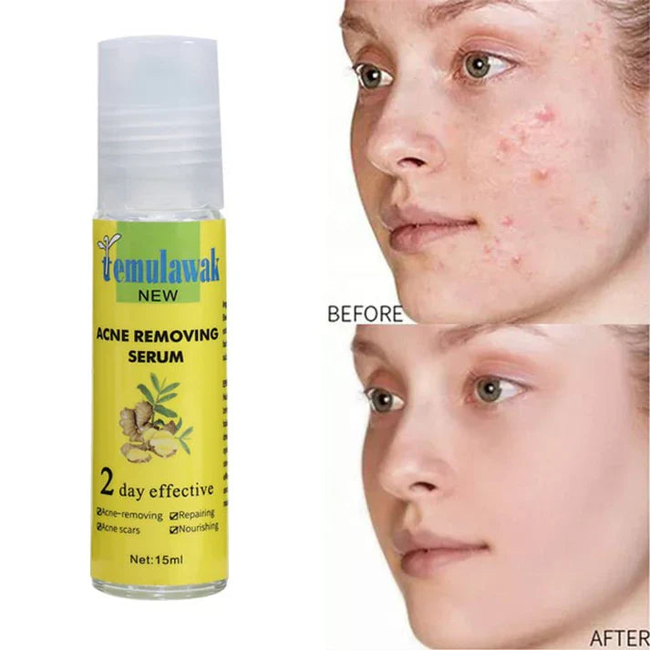 Temulawak - New Acne Removing Serum (Original) – KSA DROP
