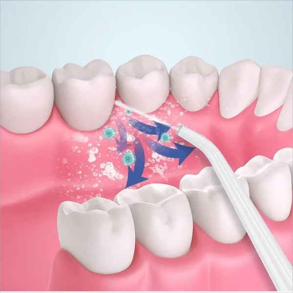3 In 1 Oral Irrigator – KSA DROP